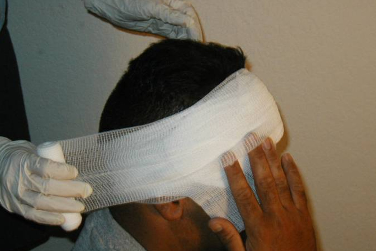 सिर की हल्की चोट से भी घातत, हो सकते हैं गंभीर परिणाम | Patrika News ...