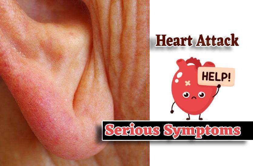 Heart Attack Serious Symptoms: बाल झड़ रहे हैं तो हो जाएं ALERT ...
