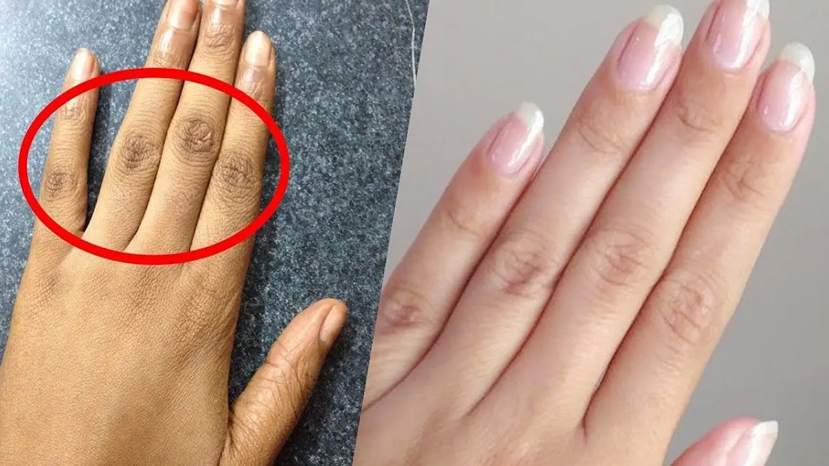 उंगलियों के कालेपन को दूर करने के लिए ये 4 घरेलू उपाय हैं असरदार | Home ...