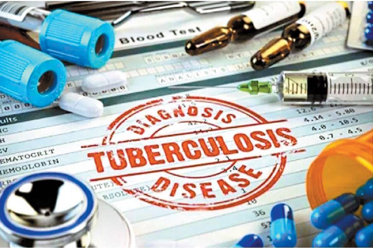 BCG Vaccination Campaign: 9. 70 लाख लोगों को लगना है ये टीका, क्या आपने ...