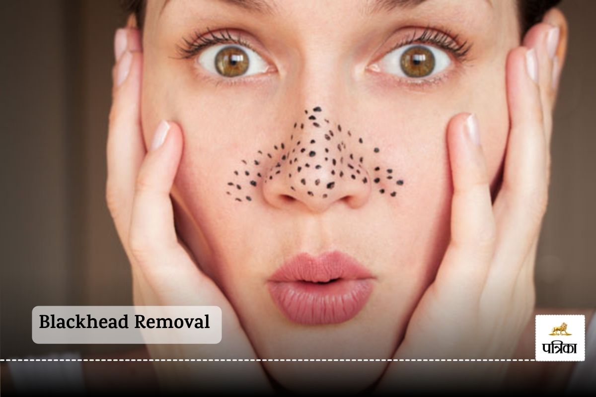 Blackhead Removal Tips: ब्लैकहेड्स की समस्या से छुटकारा चाहिए ? इन टिप्स से पाएं साफ और चमकदार त्वचा