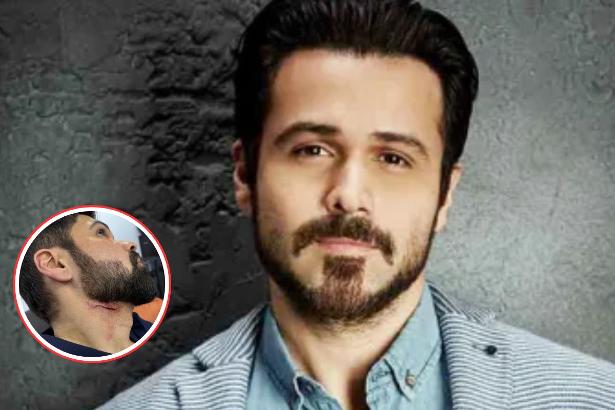 Emraan Hashmi हुए लहूलुहान, कट गई गर्दन, फोटो में देखें हाल | Patrika ...