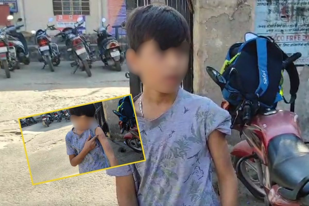 Ajmer News: प्रिंसिपल ने छठी कक्षा के छात्र को बेरहमी से पीटा, परिजनों ...