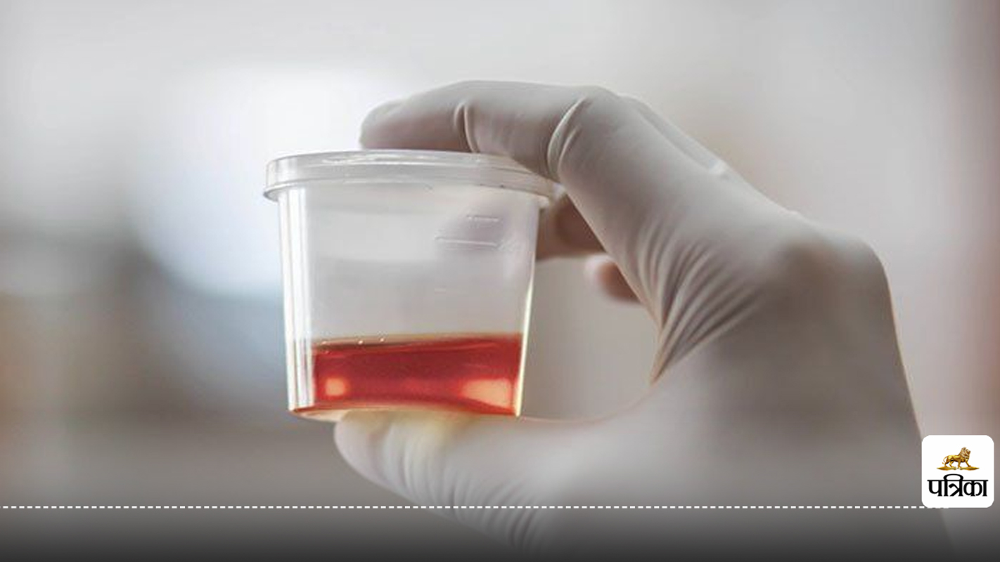 Blood in Urine : पेशाब में खून आना खतरे की घंटी, तुरंत कराएं जांच ...
