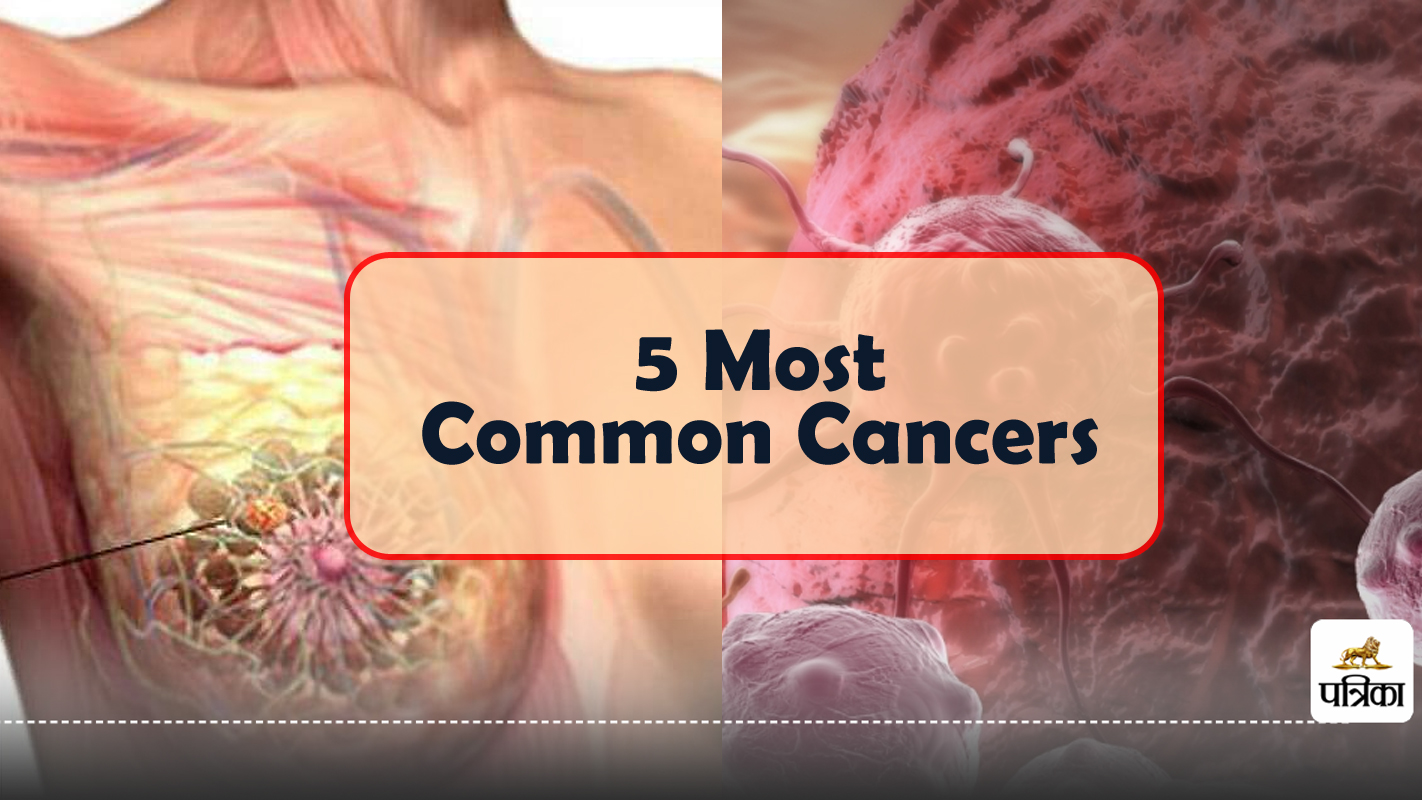 World Cancer Day 2025 : 5 आम कैंसर और उन्हें पहचानने के तरीके | World ...