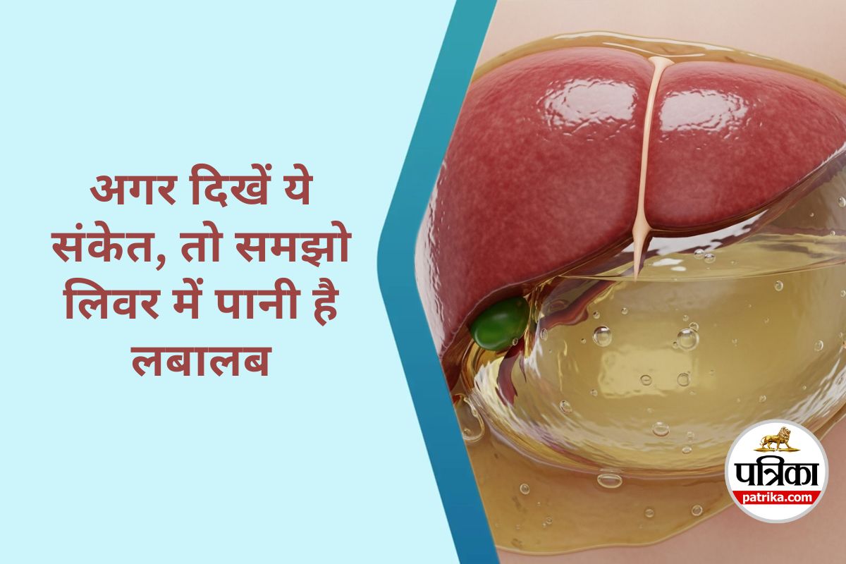 Water Fluid in Liver : ये लक्षण दिखें तो समझ जाएं पानी से लबालब भर गया ...