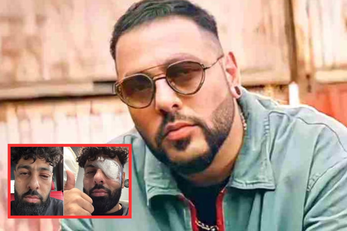 Badshah Injured: रैपर बादशाह के चेहरे का हुआ बुरा हाल, एक आंख पर बंधी ...