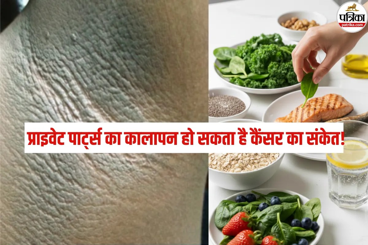 Skin Disease: गर्दन और प्राइवेट पार्ट्स का कालापन बना सकता है आपको इस ...