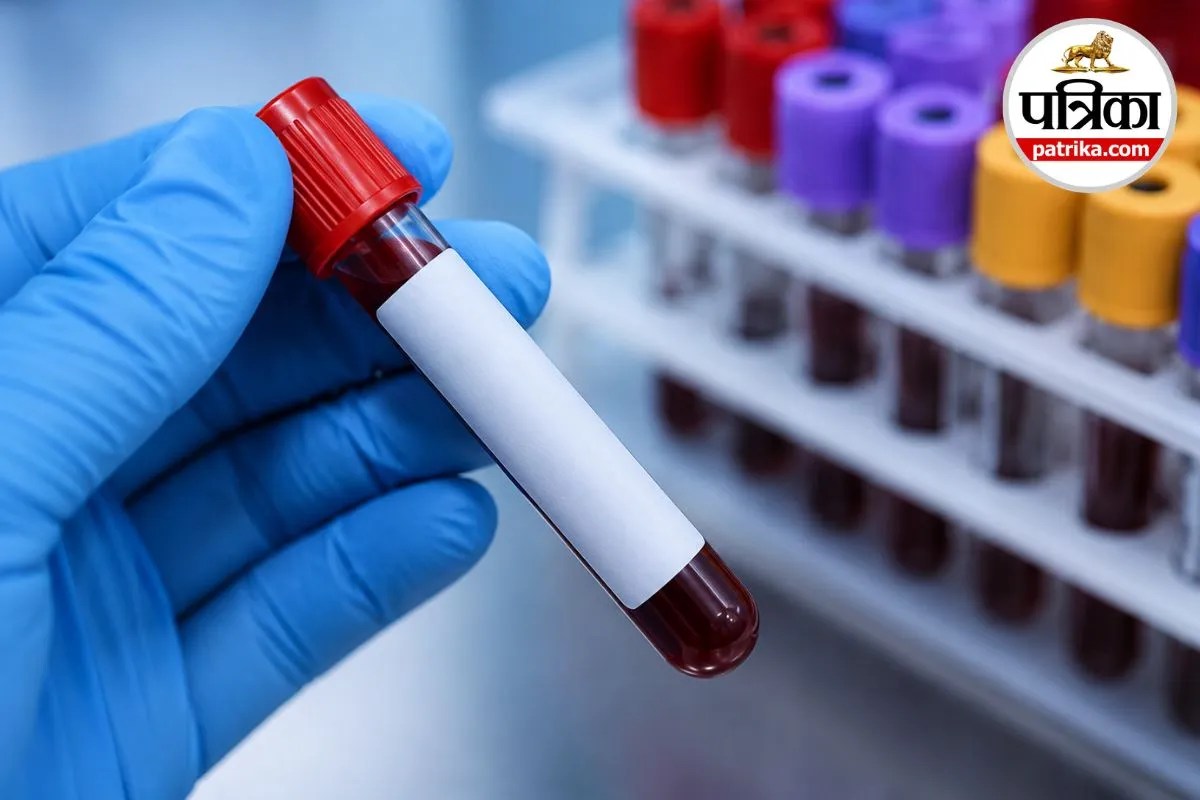 Nipah Virus: केरल के 43 वर्षीय मरीज की हालत गंभीर, WHO और CDC से जानिए ...